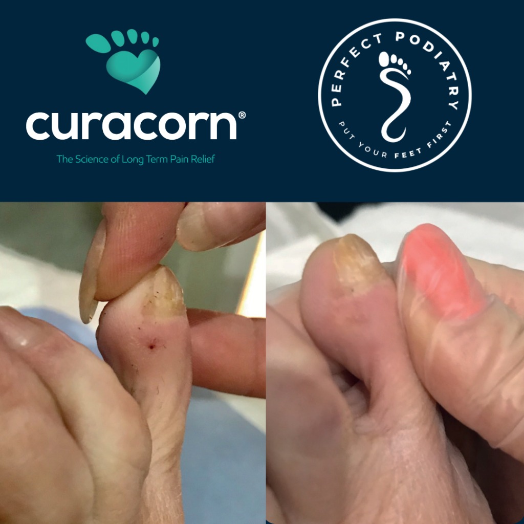 Perfect Podiatry – Perfect Podiatry